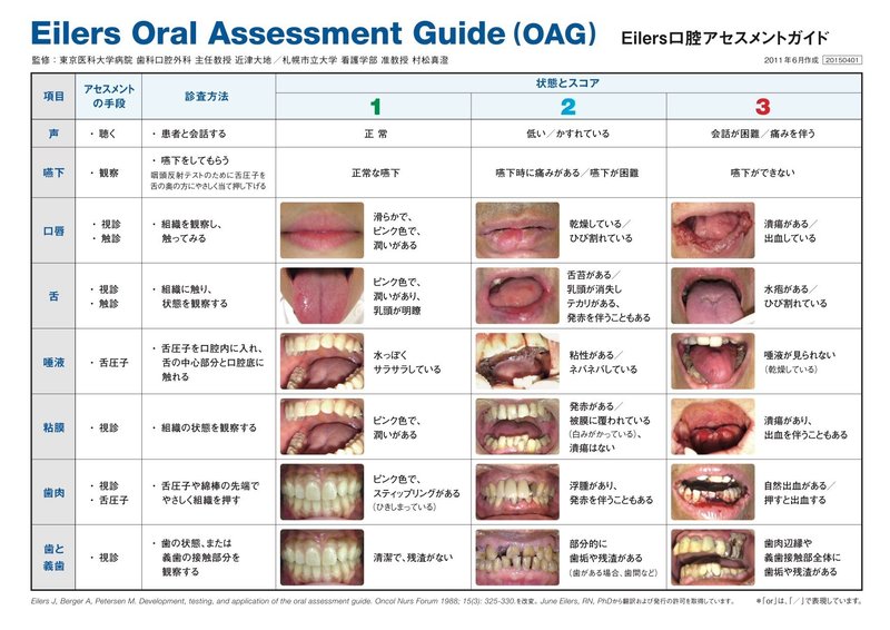 口腔アセスメントを知っていますか？（歯科医療者以外が簡便に使用できる口腔評価ツール）｜suusan.spot