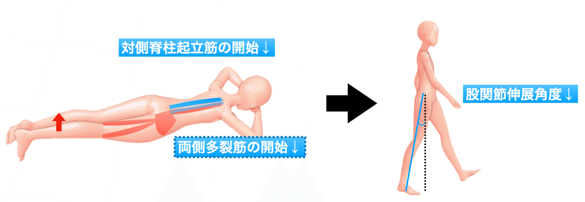骨盤荷重伝達障害の評価とアプローチ〜ASLRとPHEの理解と臨床活用〜｜理学療法士による臨床のためのnote