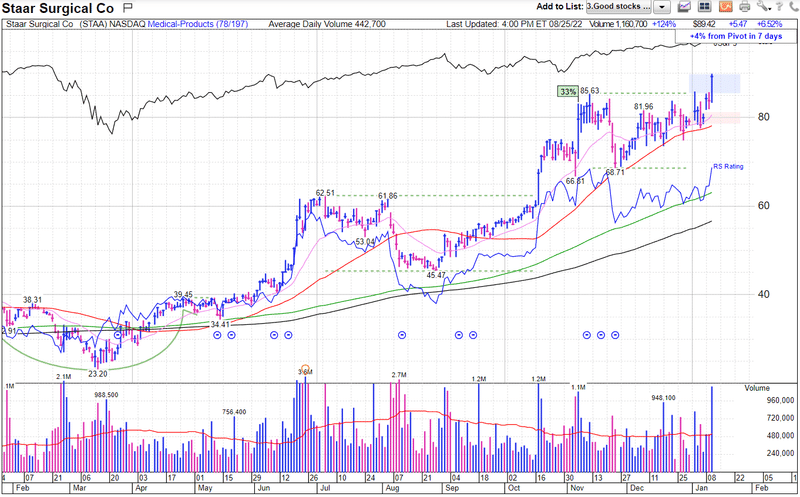 ミネ先生購入Chart - 日足｜kitakitune｜note