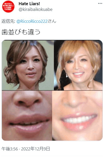 FNS歌謡祭。🌟第2夜。(後半)🌟｜AOR@白玉城より｜note