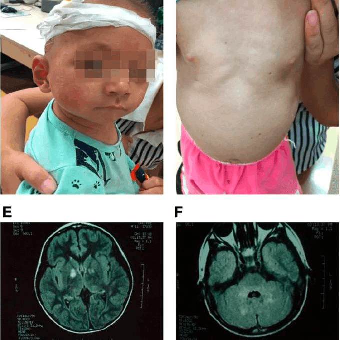 【#Rdiag 放射線科医の勉強】2022年12月のまとめ｜Rdiag