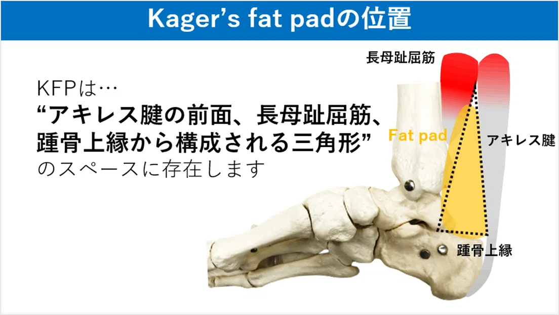 Kager’s fat padの臨床評価と介入 ～隣接する組織と動きを捉える～｜Y.K