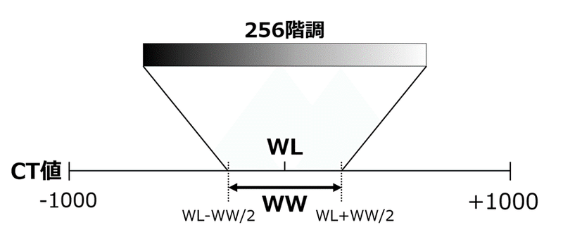 X線CT認定対策問題（1）｜MRI認定試験対策ノート