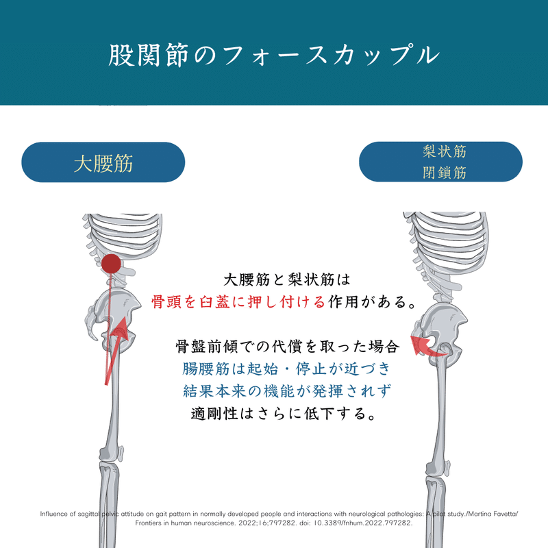 groin painに対する治療戦略｜Synergist lab.｜note