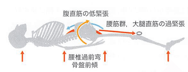 脳卒中リハビリの介入姿勢の注意点について 背臥位 |理学療法メモ