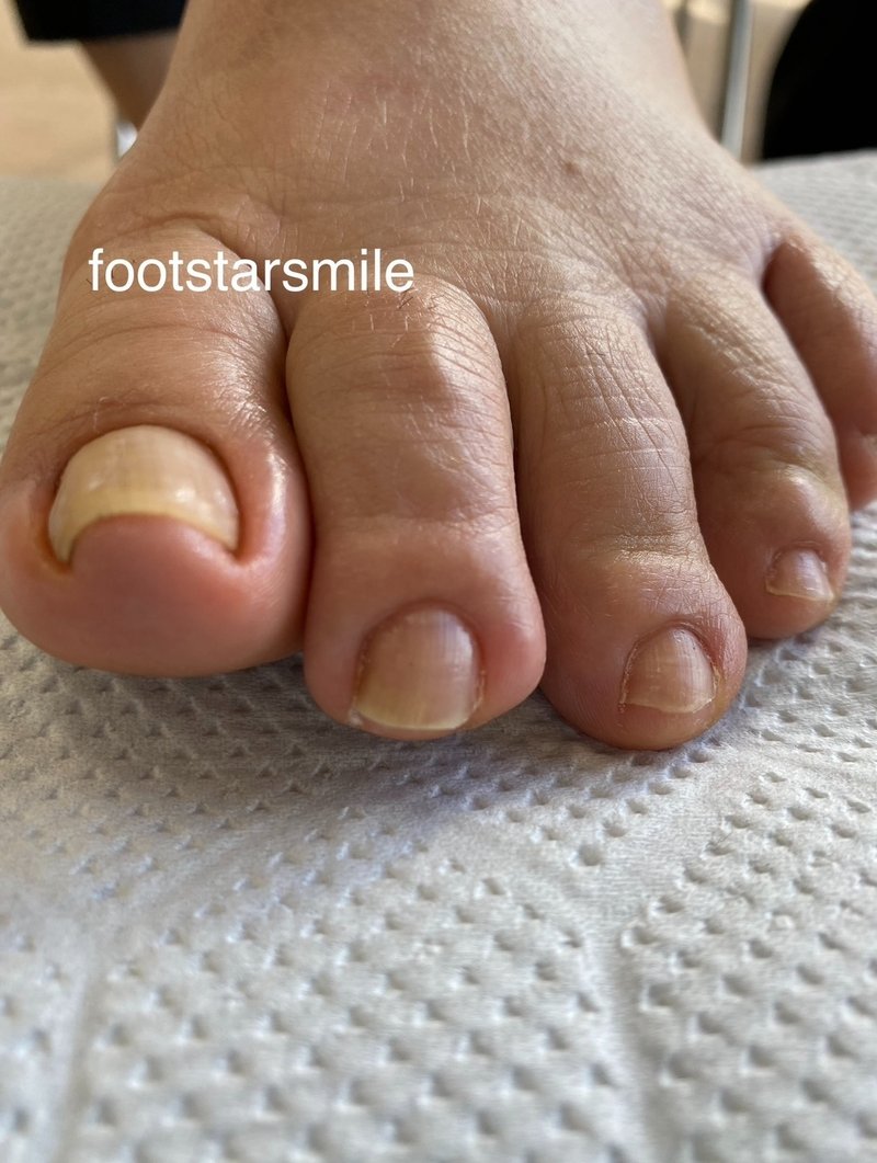 なぜ足部・足爪の困りごとが生まれるのか？できる備えとは？ Part2｜阿邊里恵_rie abe