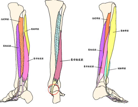 足関節外果骨折ORIF後のリハビリテーションについて｜Qlabity (クラビティ)