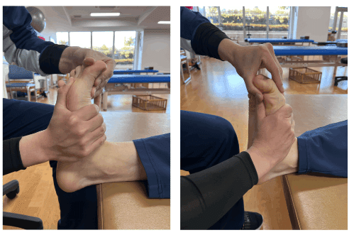 足関節外果骨折ORIF後のリハビリテーションについて｜Qlabity (クラビティ)