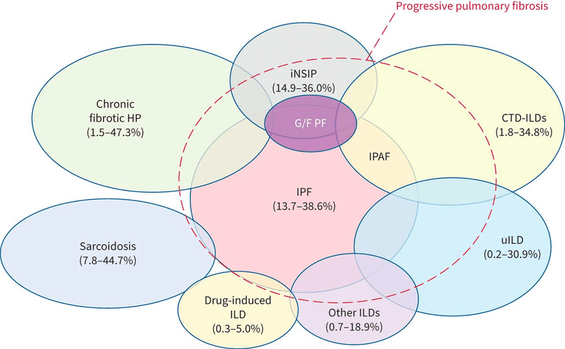 特発性肺線維症：治療病名：“Progressive Pulmonary Fibrosis":PPFとして明確化｜Makisey｜note