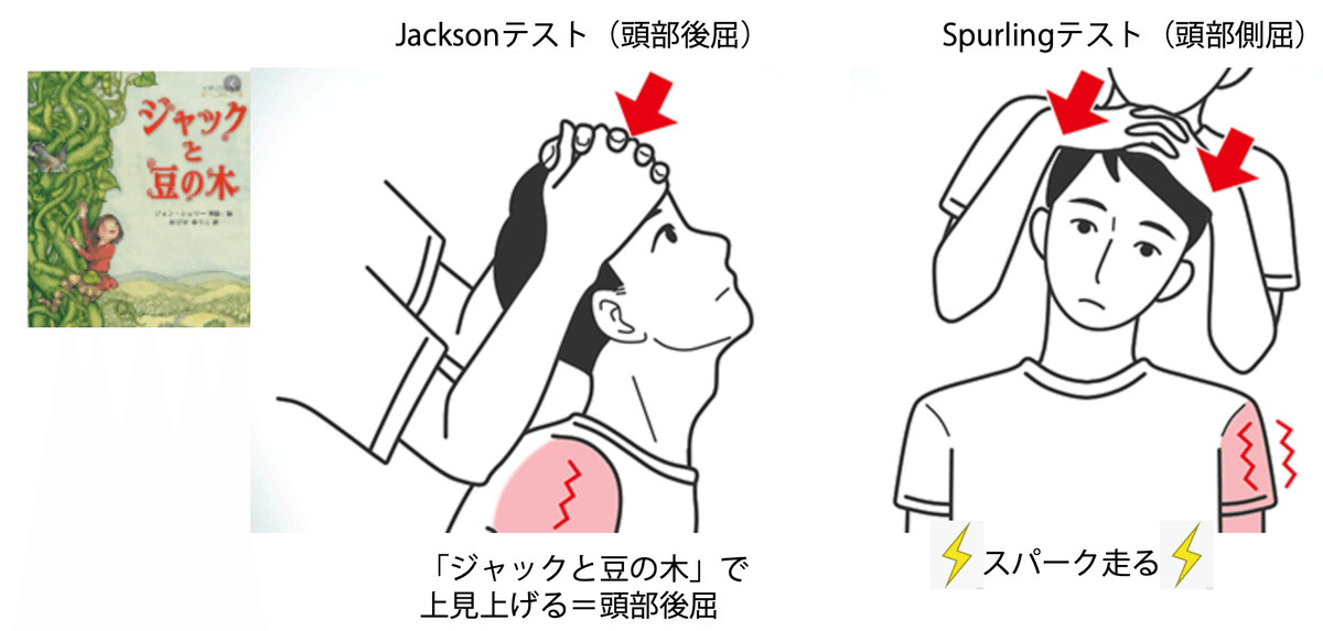 第58回理学療法士国家試験 午前31-35の解説｜Sixty_valleyのページ