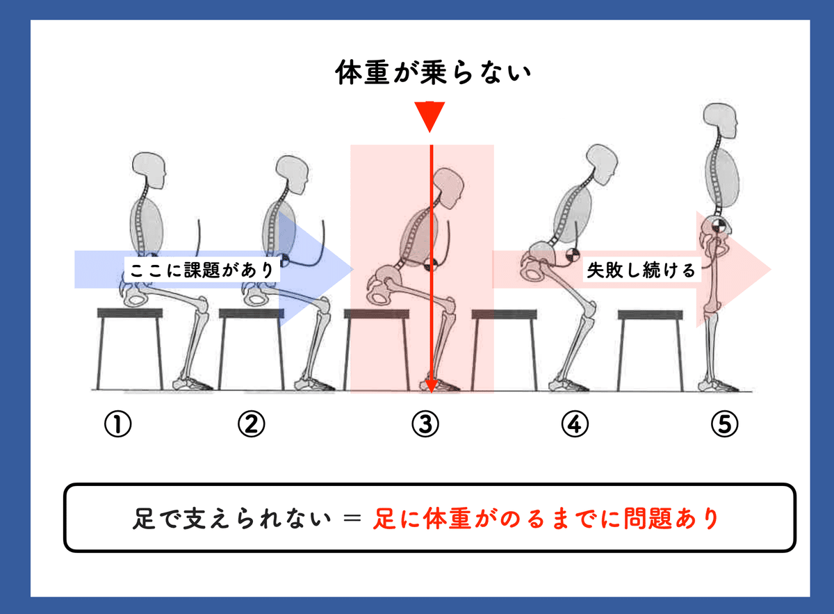 【HAMT】脳卒中の動作介助〜立ち上がり編〜｜櫛引翔太 鍼灸師 × 脳卒中認定PT