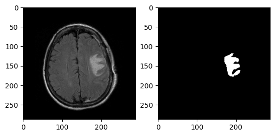 Pythonを使ってDICOM画像から体積評価｜Shirasagi