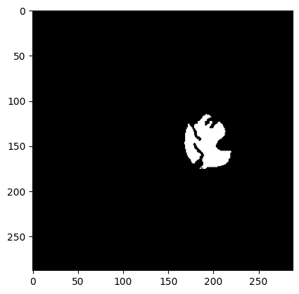 Pythonを使ってDICOM画像から体積評価｜Shirasagi