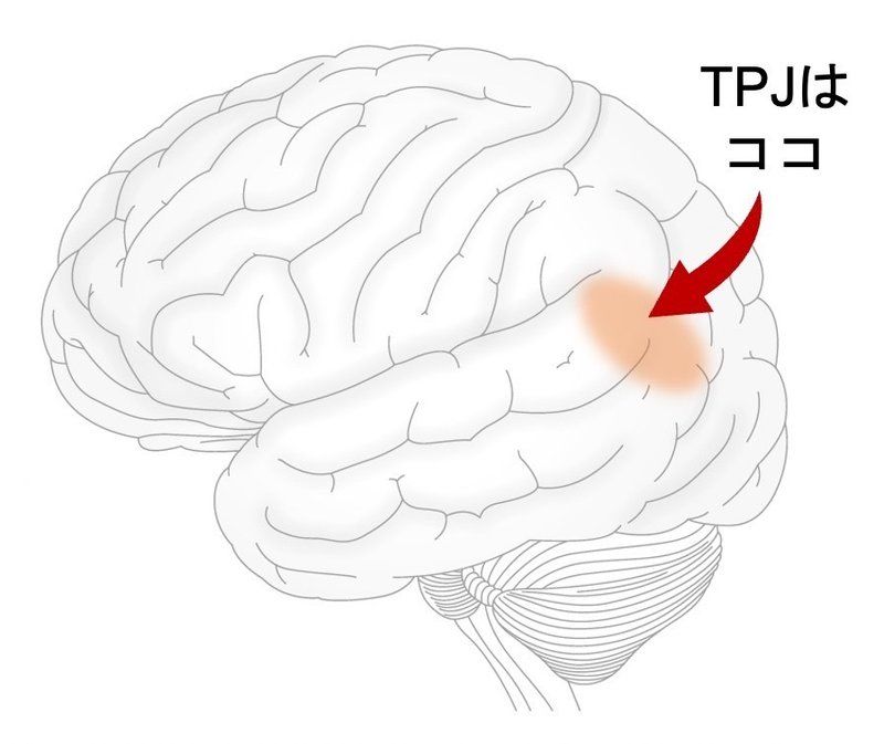 シュードバッハ②TPJ｜communi8｜note