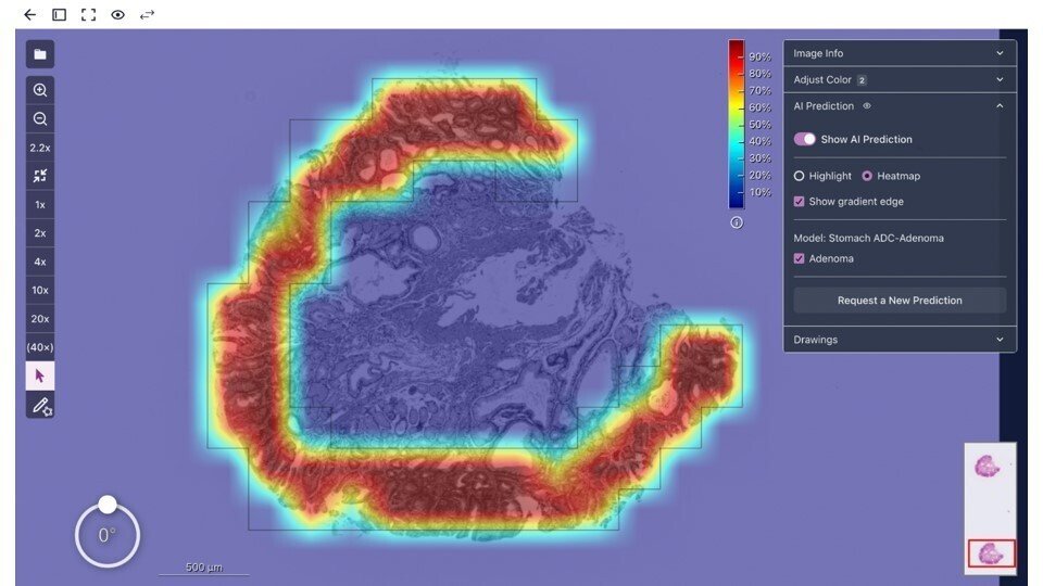 小さな積み重ねで医療×AIによる大きな革新を。医療現場に技術で貢献する「メドメイン」｜DEEPCORE / KERNEL