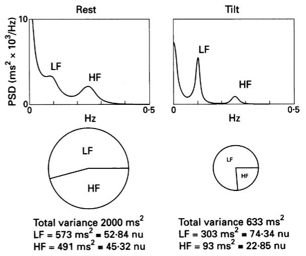 心拍変動：LFまたはHFの絶対値とは？｜脳科学リサーチ【オフィスワンダリングマインド】