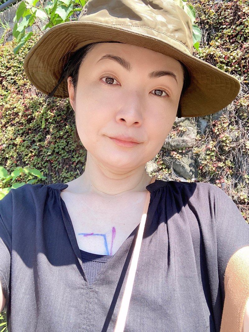 乳がん記録｜放射線治療（3）~照射初回＆2回目~｜Tomomi Kawaguchi