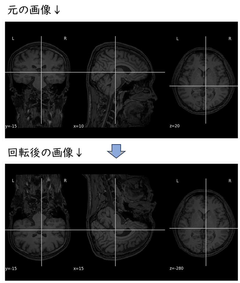 【Python初心者向け】医療画像（MRI/CT/PET等）を読み込んで任意に回転させた画像を出力する｜小倉 淳 / Jun Ogura