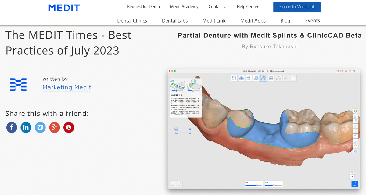 Medit SplintとMedit Designを使用したパーシャルデンチャー作成の方法（歯のデジタル抜歯方法は無料公開中） 2023年11 ...