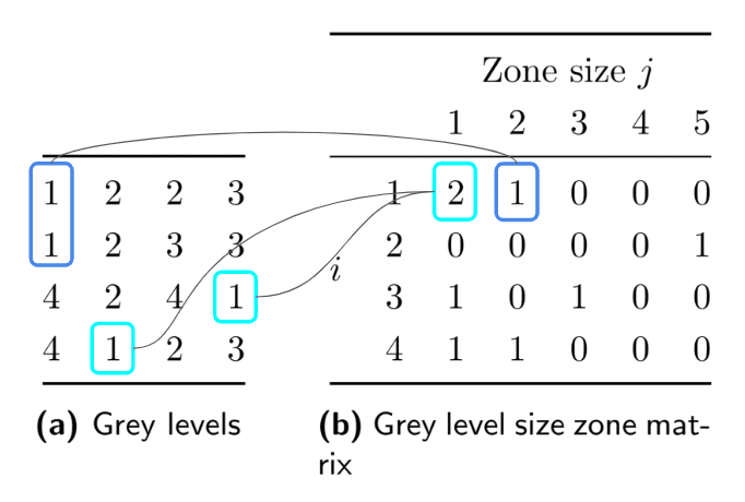 Radiomics超入門：Gray Level Size Zone Matrix特徴｜VIS_TATSUAKI