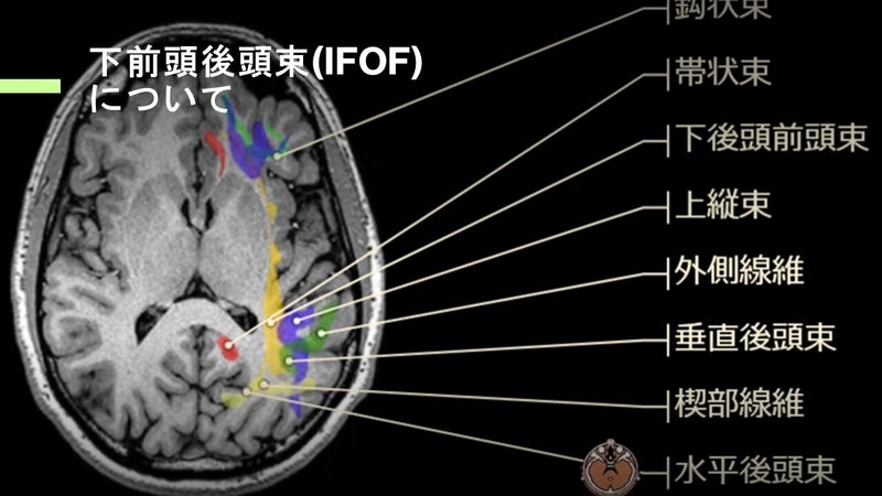 下前頭後頭束(IFOF)について｜くろ 作業療法士
