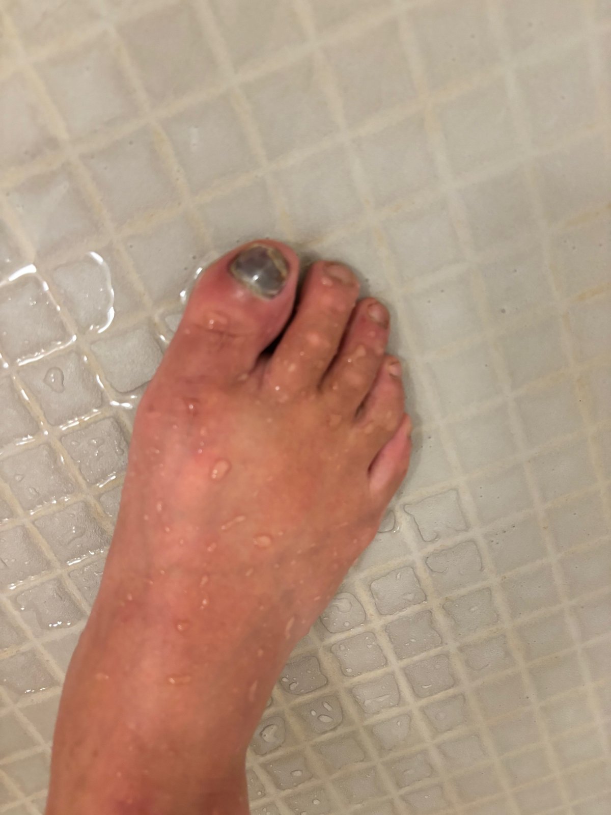 激キツ【FTR秩父＆奥武蔵100k】初ロングレースレポ（前半）｜MIHO/酒婦ランナー