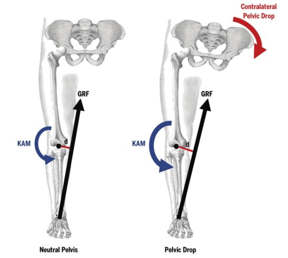 変形性膝関節症の臨床評価とアプローチ｜理学療法士による臨床のためのnote