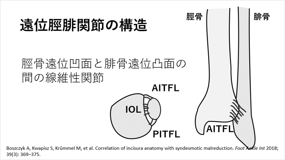 捻挫で必ず評価するべき部位 前下脛腓靭帯損傷を見逃すな！ ～不安定性や変形リスクの増大～｜Y.K