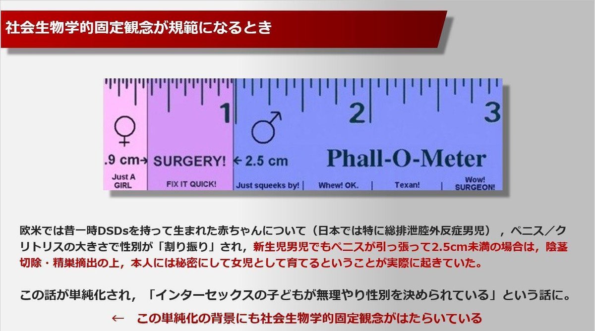 DSDsの昔の「性別割り当て」と現在の「性別判定」の違い。そしてトランスの皆さんの言う「割り当てられた性別」との違い。｜ネクスDSDジャパン