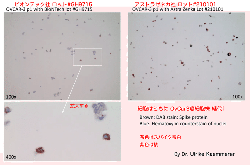ケビンさんの研究。培養がん細胞株のゲノムにワクチン由来のプラスミドDNAが取り込まれて複製されました｜Dr Pilon (パイロン先生)