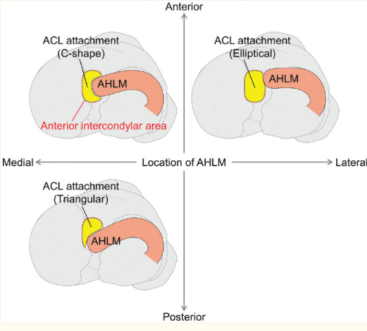 20240404: native ACL・外側半月板前角・解剖・付着形状｜Brain storm conditioning 〜 脳からコンディショニング