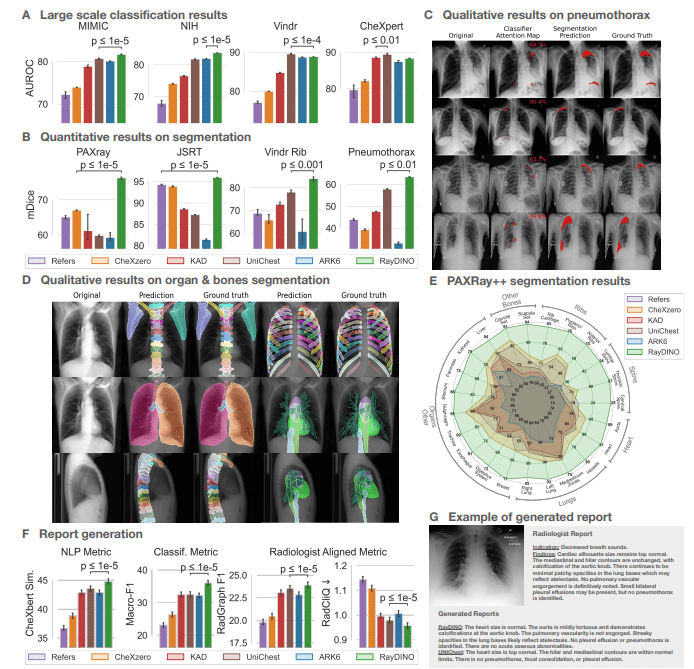 X線診断の精度向上を実現する自己教師型AIの効果｜0xpanda alpha lab