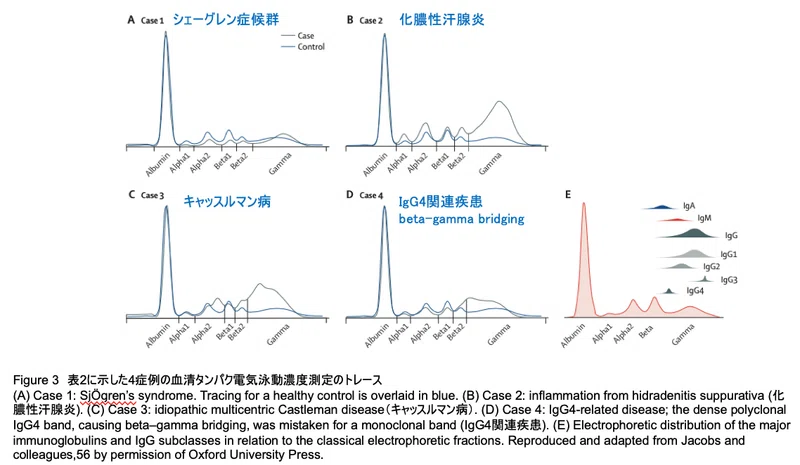 Polyclonal hypergammaglobulinaemia: assessment, clinical interpretation ...