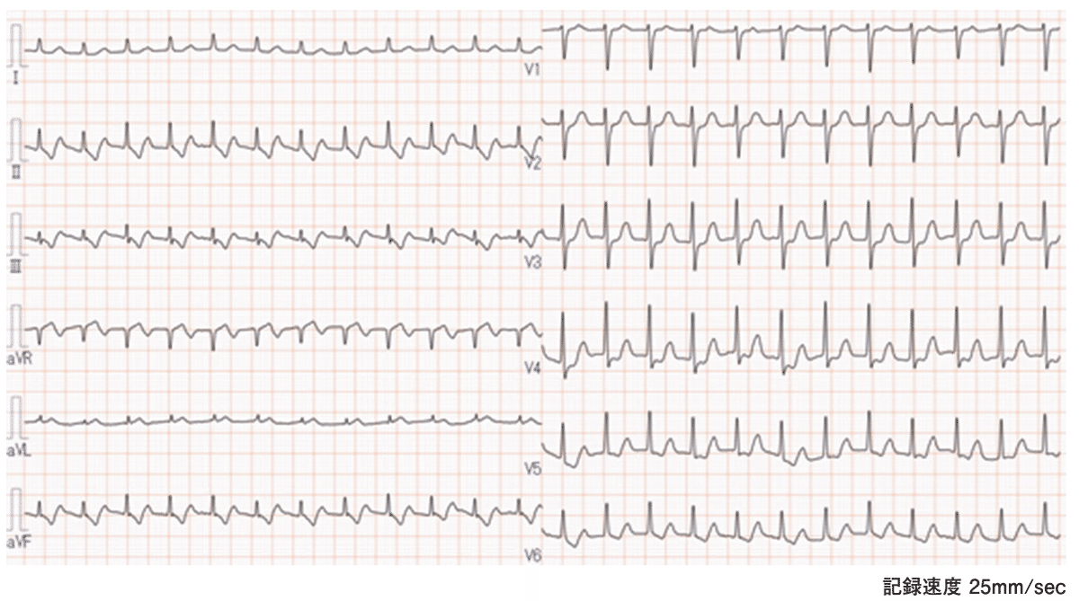 118回医師国家試験 循環器内科医の視点から｜Haruna