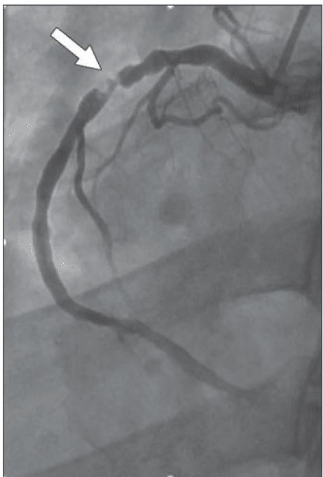アメリカで一番使われている医療AI：Heart Flow FFRCTについて｜川野 貴久