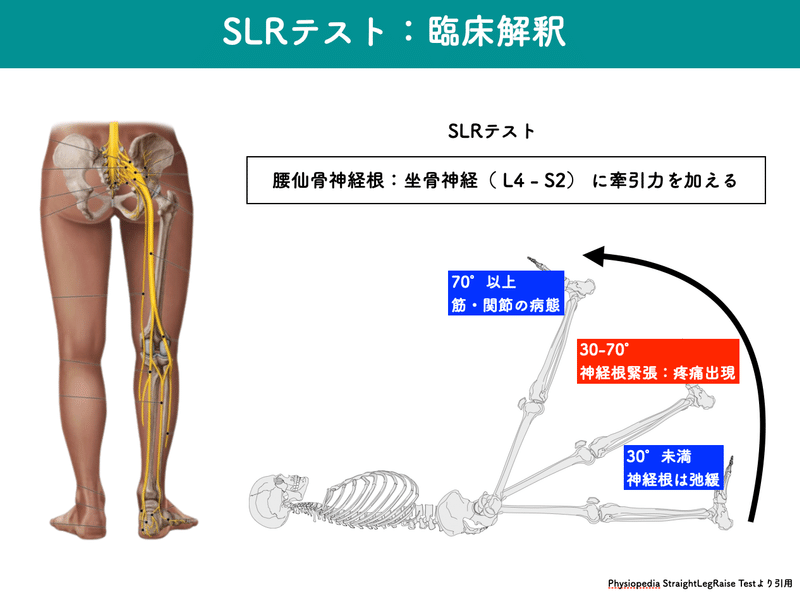 【HAMT】運動機能性評価-SLRテストから体幹/下肢機能を評価する-｜櫛引翔太 鍼灸師 × 脳卒中認定PT