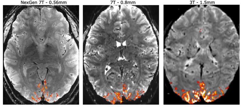 人の生きた脳の機能接続も透けて見えるfMRI｜東京 AI 研究所