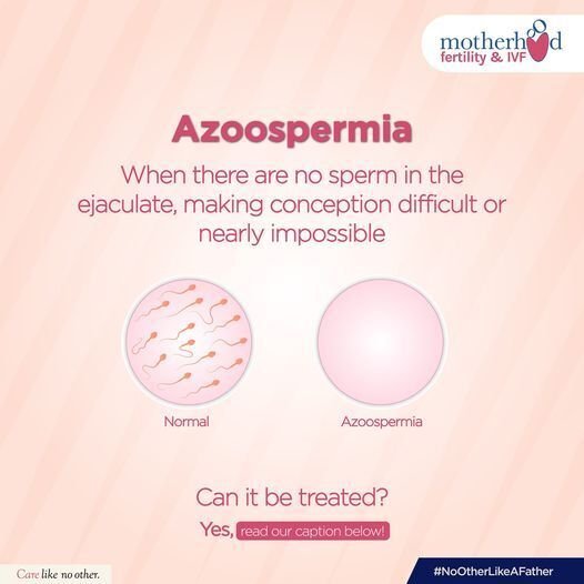 Understanding Azoospermia: Exploring Causes and Impacts on Male ...