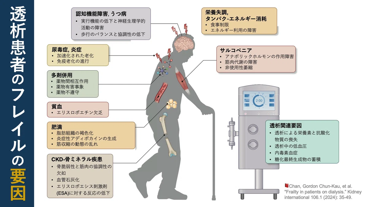 透析患者 × フレイル｜super Human 理学療法士／保健学博士 Phd 1565