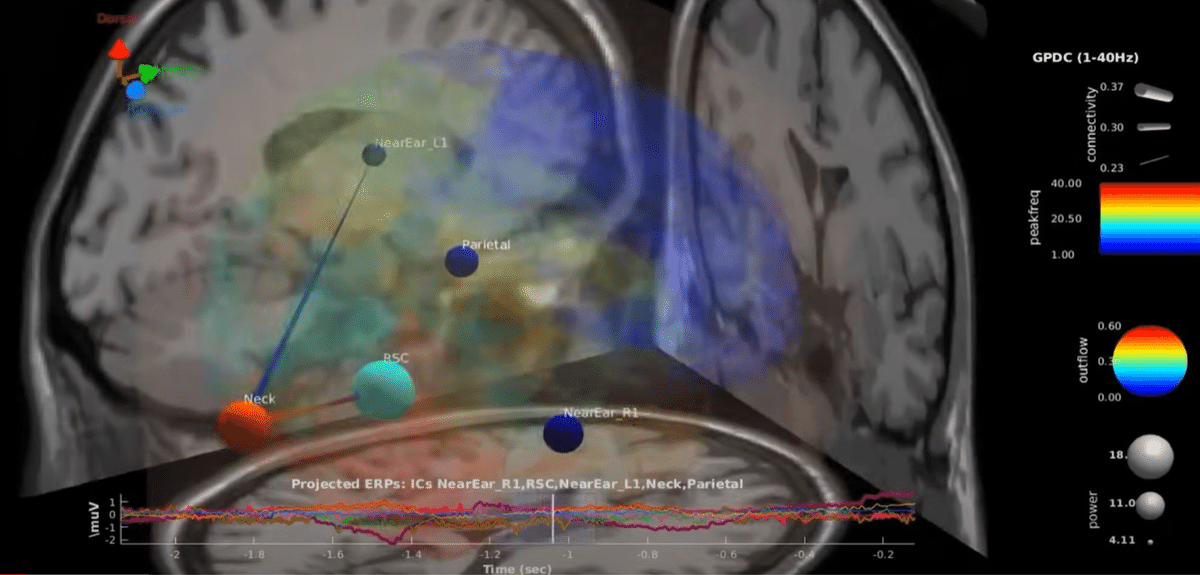 BrainGPT: 脳波を言語に翻訳する未来技術｜yamaman.【AIツールナビゲーター】