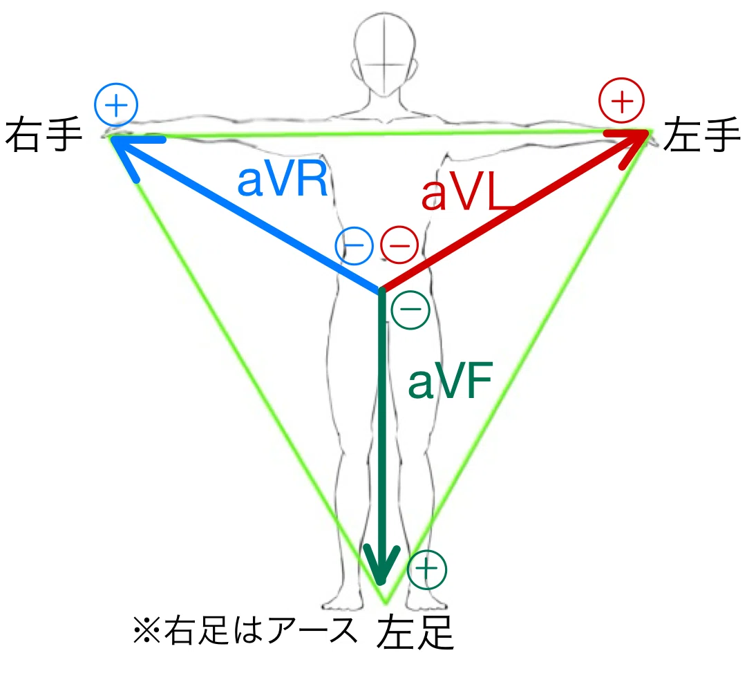 【勉強メモ】心電図 電気軸の計算方法 解説｜つかれのーと