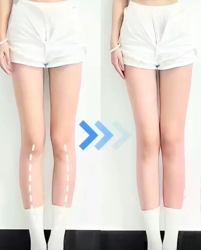 Complete Guide to Slimming Legs in 2 Months! How to Improve O-Leg and X ...