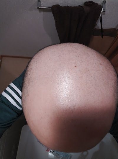 NOTEを始めて気づいてしまったこと｜Kohein