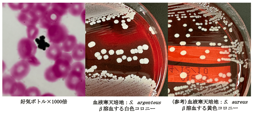 Staphylococcus argenteusについて｜kohei hasegawa