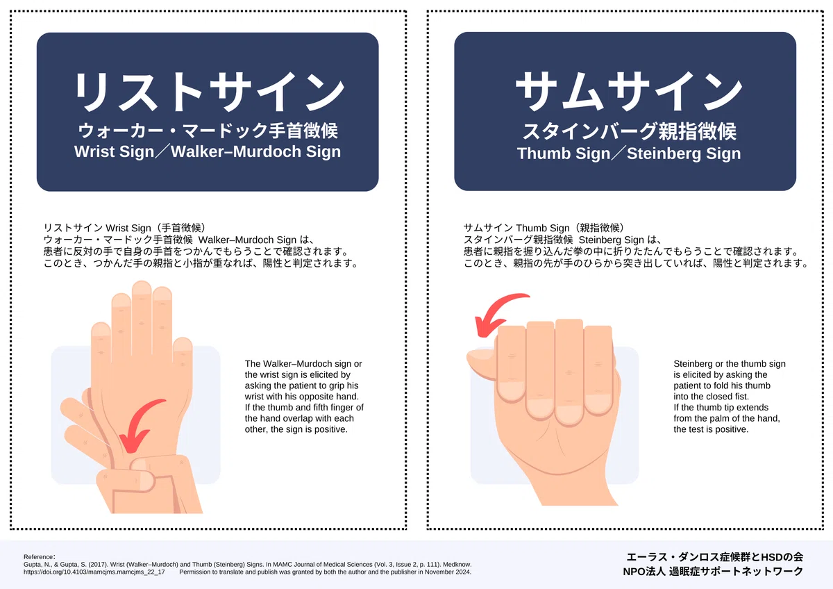 Wrist SignとThumb Sign｜国際過眠症研究啓発協会（NPO法人 過眠症サポートネットワーク）