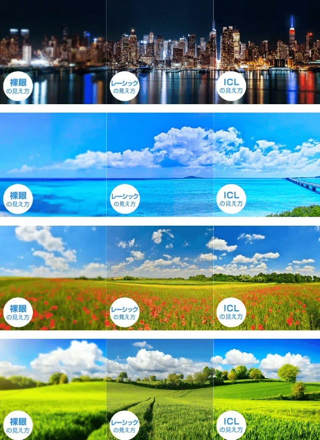 【新宿近視クリニック】ICL手術体験記 術後写真有 流れと評判口コミメリットデメリット クーポン 紹介 割引はあるの？｜Hiro＠フォロバ100