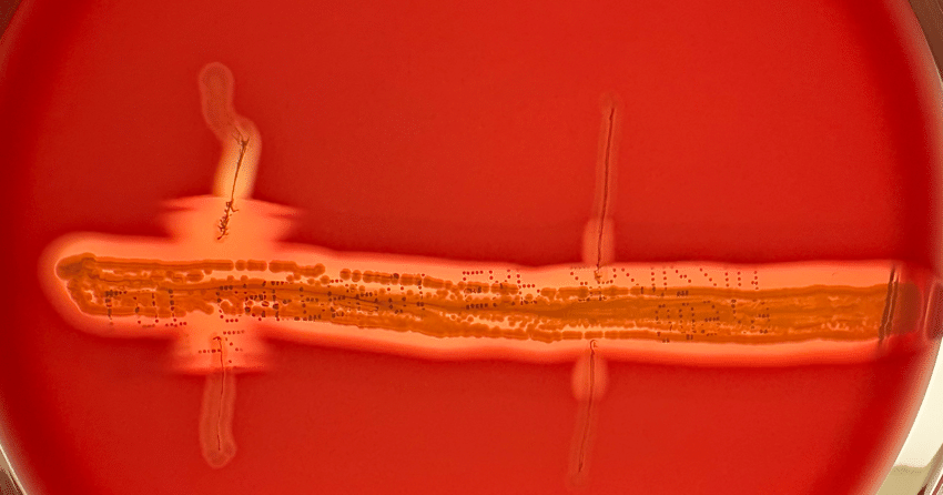 Listeria monocytogenes｜kohei hasegawa