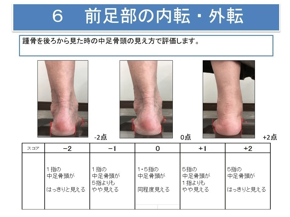 足の健康を守る！FPI-6って何？足病医の診断方法を簡単に解説｜こば👟義肢装具士｜1万人以上の足を診た靴屋
