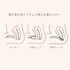 私のハナシ。｟月経カップの挿入に苦戦。｠｜marche KANON