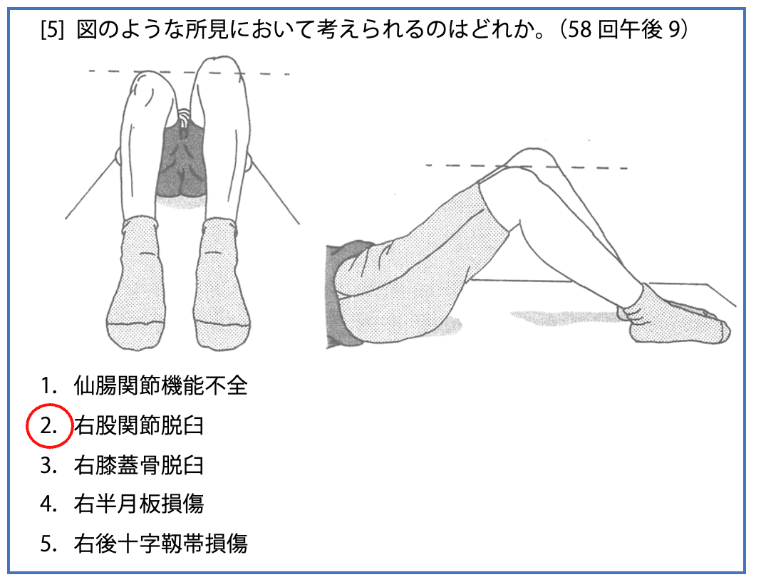 第60回理学療法士国家試験 午前86−90の解説｜Sixty_valleyのページ